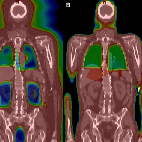 The Dynalog Viewer Program In The LINAC Control Station Download