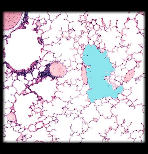 Alveolar Duct And Alveolus Histology Flashcards Quizlet