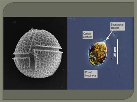 Morphology Of Protozoa Pptx Infectious Diseases Diseases And