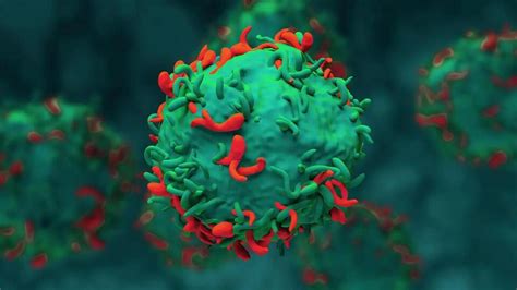 Ulcerative Colitis Next Target For Car T Cell Therapy Newsbreak