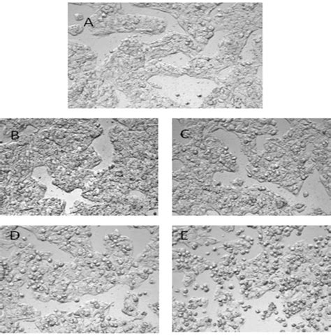 Effect Of Cadmium Of Hepg2 Cells Morphology For 24 Hours Hepg2 Cell Download Scientific
