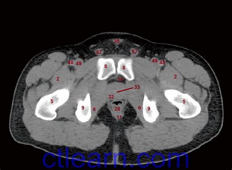 Ct Pelvis Anatomy Muscles Mri Anatomy Of Hip Joint Fr