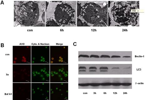 Figure 1 From Autophagy Inhibition Through Pi3kakt Increases Apoptosis