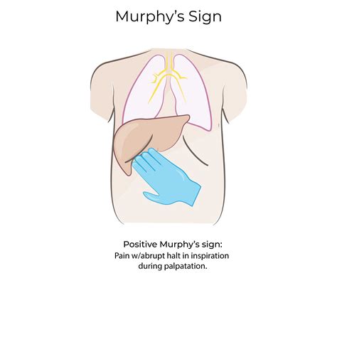 Murphy Sign Murphy Sign