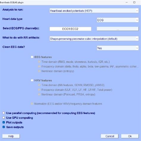 4 Filtered And Smoothed Ecg Signal With Identified R Peaks Top Download Scientific Diagram