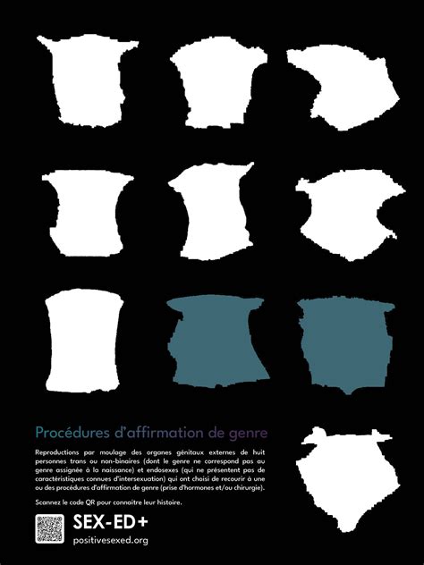 Poster Procédures d affirmation de genre SEX ED