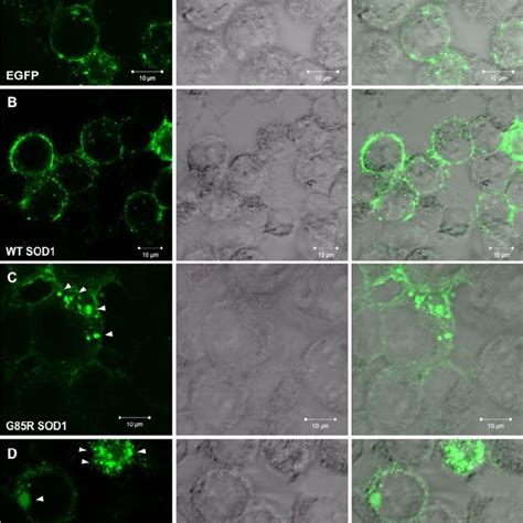 Subcellular Localization Of Egfp Fused Sod1 In A Neuronal Cell Line