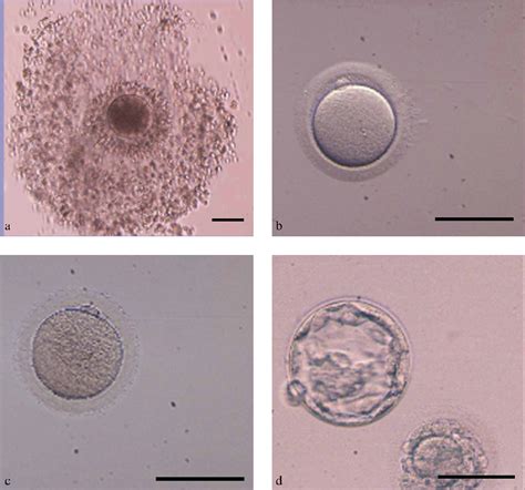Embryo Transfer Procedure Semantic Scholar