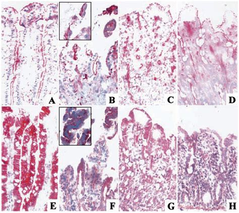 Zonula Occludens 1 Ad And Occludin Eh Expression During