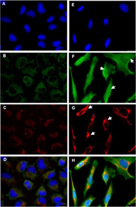 Mitochondria Staining And Cytochrome C Release In Hela Cells In The