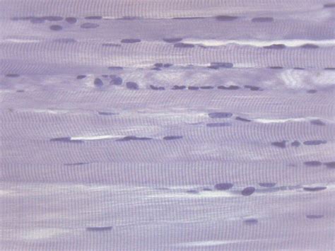 Human Skeletal Muscle Ls Prepared Microscope Slide Skeletal
