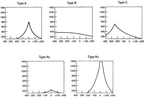 Tympanometry Audiology Dr Nokes Flashcards Quizlet