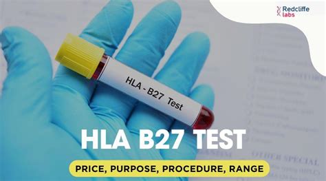 Hla B27 Test Price Purpose Procedure Range And More
