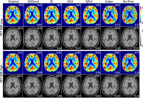 Results On Simulated PET MRI Using BW20 With 2 2 Undersampled MRI