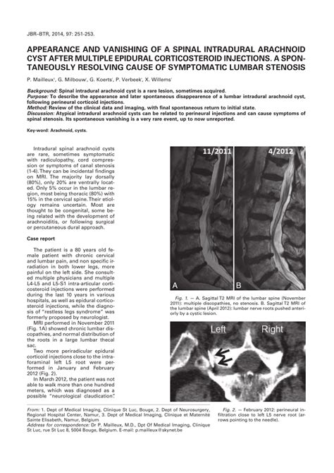 Pdf Appearance And Vanishing Of A Spinal Intradural Arachnid Cyst