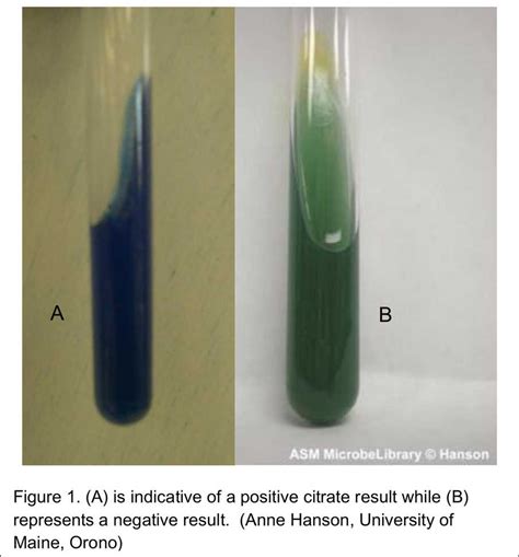 Solved Citrate Test Purpose The Citrate Test Screens A Bacterial