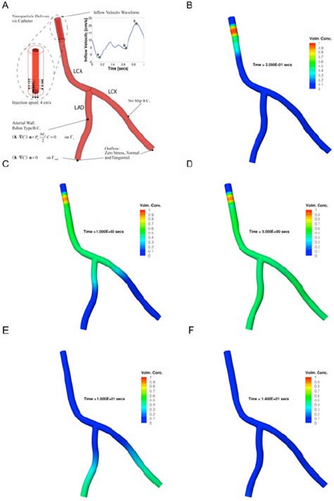 Nanoparticle Transport In A Patient Specific Vascular Tree Download Scientific Diagram