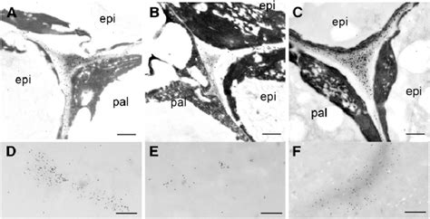 Gold Immunolabeling Of Hg Epitopes In Epidermal Cell Walls Of The Seed