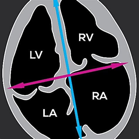 Schematic Representation Of A Longitudinal Section Of The Four Cardiac