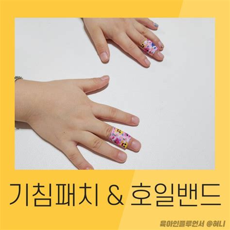 아기 기침 심할때 기관지확장제 패치 민간요법 호일밴드 추천 네이버 블로그