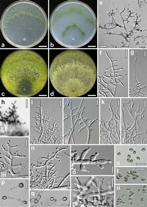 Clonal Species Trichoderma Parareesei Sp Nov Likely Resembles The Ancestor Of The Cellulase