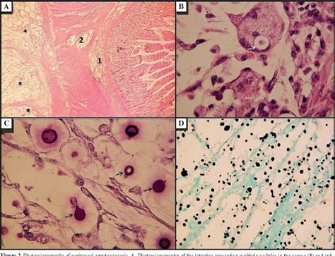 Figure 2 From Peritoneal Cryptococcosis In A Dog Semantic Scholar