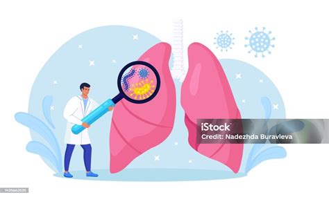 폐학 돋보기로 폐를 검사하는 작은 의사 결핵 폐렴 폐암 치료 또는 진단 호흡기 질환 질병 또는 문제에 대한 내부 장기 검사 호흡기 질환에 대한 스톡 벡터 아트 및 기타