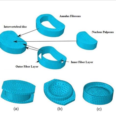 Functional Spinal Unit FSU Download Scientific Diagram