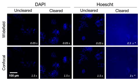 Hoechst Dapi Staining At Sarah Alanson Blog
