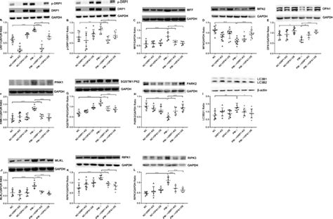 Effect Of Pm25 Drp1 Knockdown Kd And Opa1 Overexpression Oe On