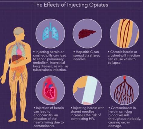 Different Types Of Opiates