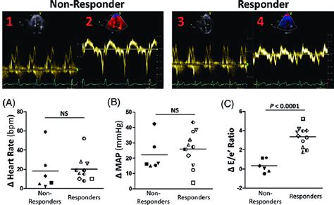 Example Of A Doppler Mitral Inflow Velocity Tracing For A Download Scientific Diagram