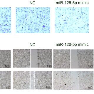 MiR 126 5p Mimics Can Inhibit The Migration Of MCF7 Cells A