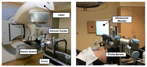 Robotic Assisted Ultrasound System To Support Intrafractional Imaging Download Scientific Diagram