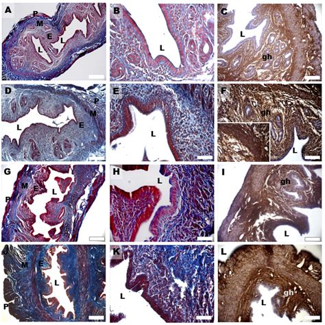 Mallory Trichrome Abdeghjk And Col1 Cfil Staining Of