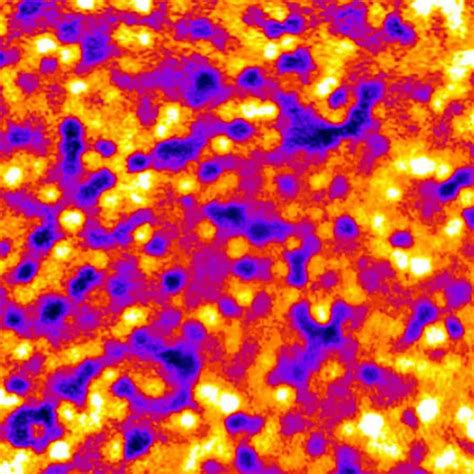 Imaging Method Reveals Long Lived Patterns In Cells Of The Eye