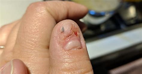 Mild Gore Album On Imgur