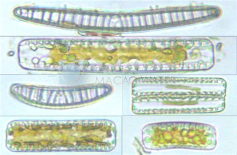 Epithemia 澳門淡水藻類