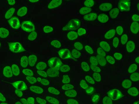 Ana Pattern Identification