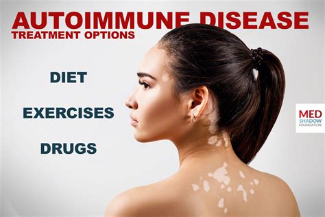 Diet Exercise And Drugs For Autoimmune Diseases Medshadow Foundation Independent Health