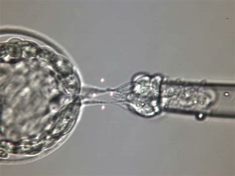 Do You Know The Different Laser Applications Here Are 4 Ways To Use Your Laser In The Ivf Lab