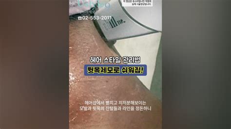 헤어라인제모가격 어떻게 다를까 네이버 Tv