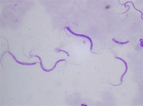Proteus Spirilium