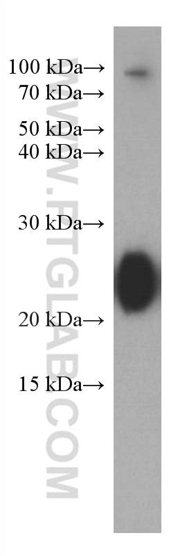 Human Ig Lambda Chain Antibody 67762 1 Ig Proteintech