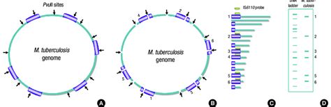 Principles Of RFLP A M Tuberculosis Genome With Insertion Segment