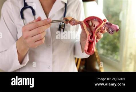 Gynecologist Shows Structure Of Uterus On Model Of Uterus Treatment And Examination Of Female