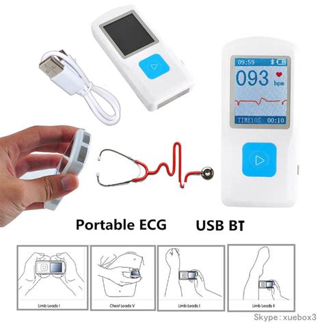 Buy Contec Portable Ecg Heart Rate Machinemonitor Pm10