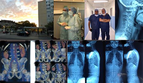 The Latest In Motion Preserving Disc Arthroplasty For Cervical And
