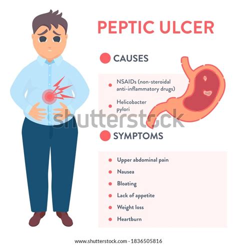 Peptic Ulcer Stomach Disease Infographic Poster Stock Vector Royalty