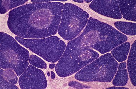 Dear Doctor Do Intra Mammary Lymph Nodes Pose A Risk